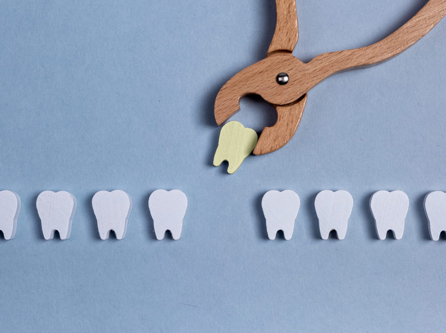 How Long Does It Take to Recover from Wisdom Tooth Removal | Medora ...